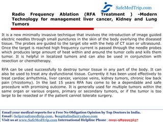 Radio Frequency Ablation (RFA Treatment ) -Modern Technology for ...