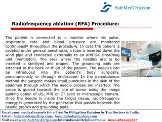 Radio Frequency Ablation (RFA Treatment ) -Modern Technology for ...