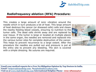Radio Frequency Ablation (RFA Treatment ) -Modern Technology for ...