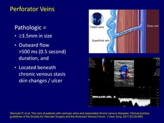 Radiofrequency ablation of varicose veins Dr. Muhammad Bin Zulfiqar | PPTX