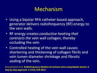 Radiofrequency ablation of varicose veins Dr. Muhammad Bin Zulfiqar | PPTX
