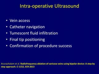 Radiofrequency ablation of varicose veins Dr. Muhammad Bin Zulfiqar | PPTX