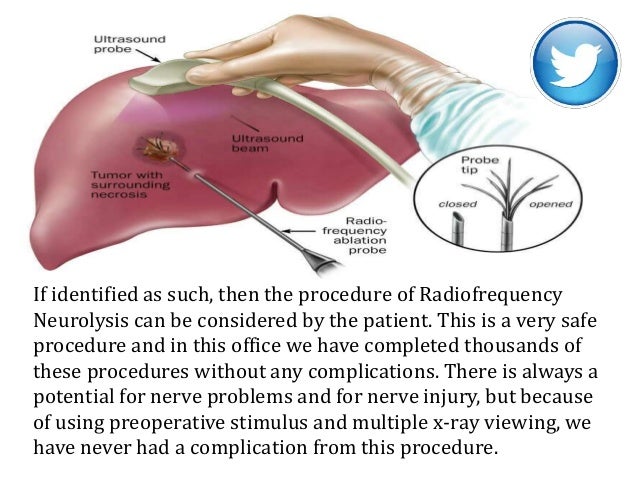 Radiofrequency Neurolysis