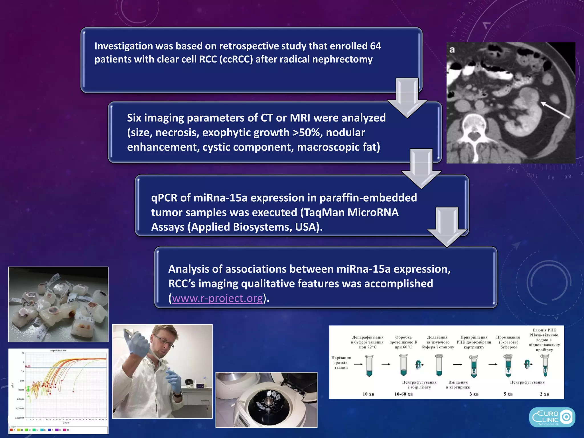 Radiogenomics of renal cell carcinoma | PDF