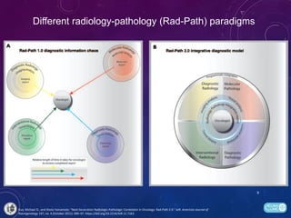 Radiogenomics of renal cell carcinoma | PDF