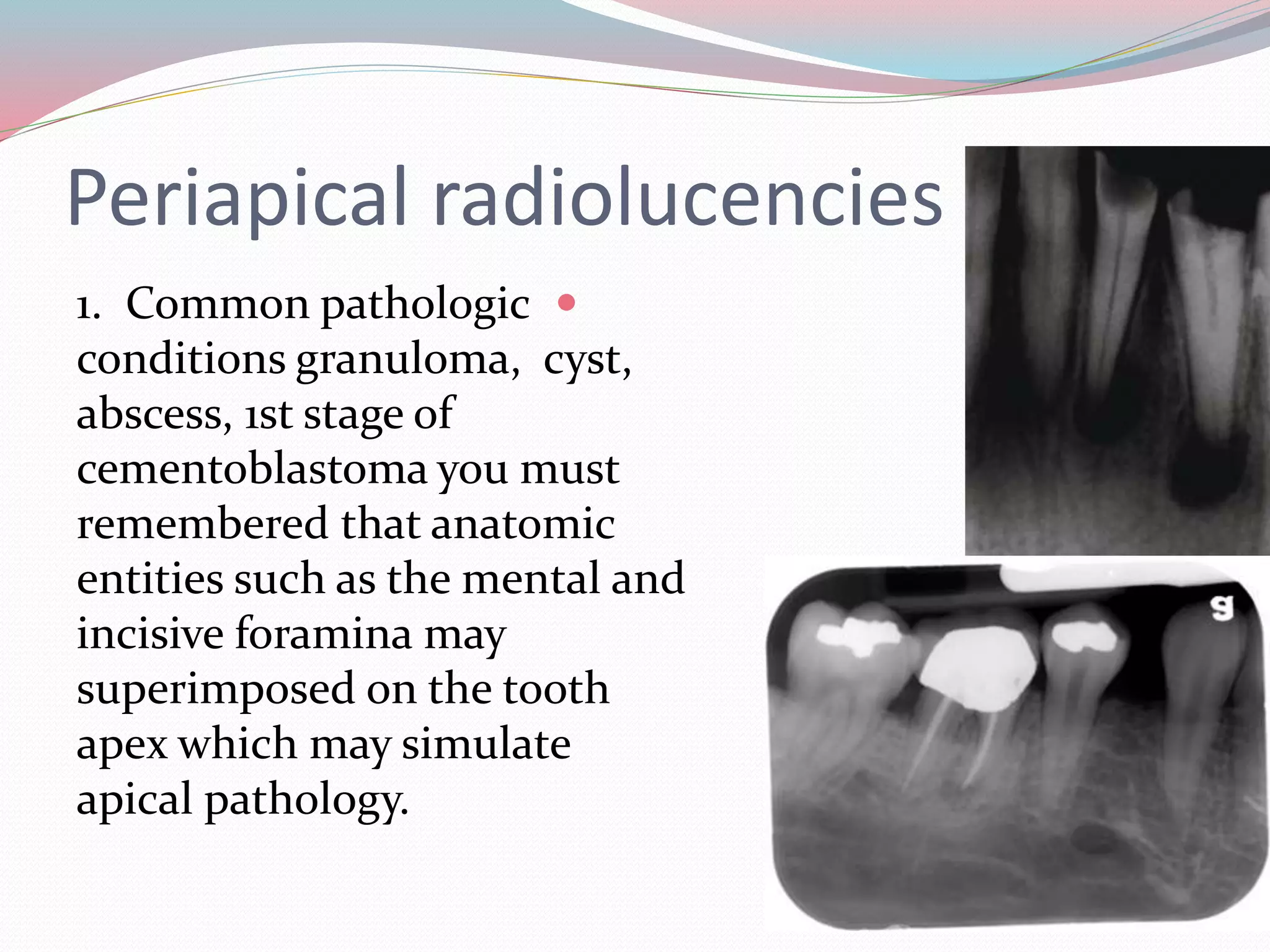 Dental common disease on x-ray | by Dr.mohammad nameer | PPTX