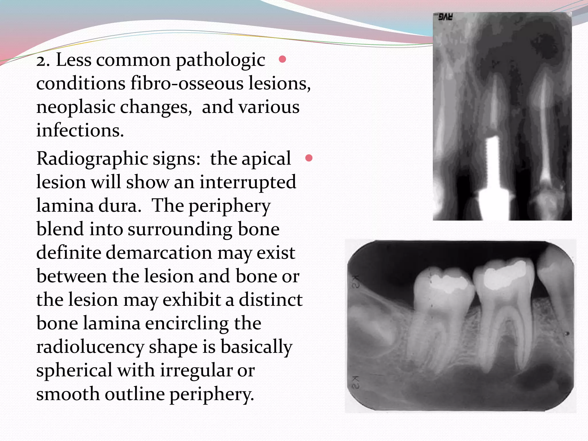 Dental common disease on x-ray | by Dr.mohammad nameer | PPTX