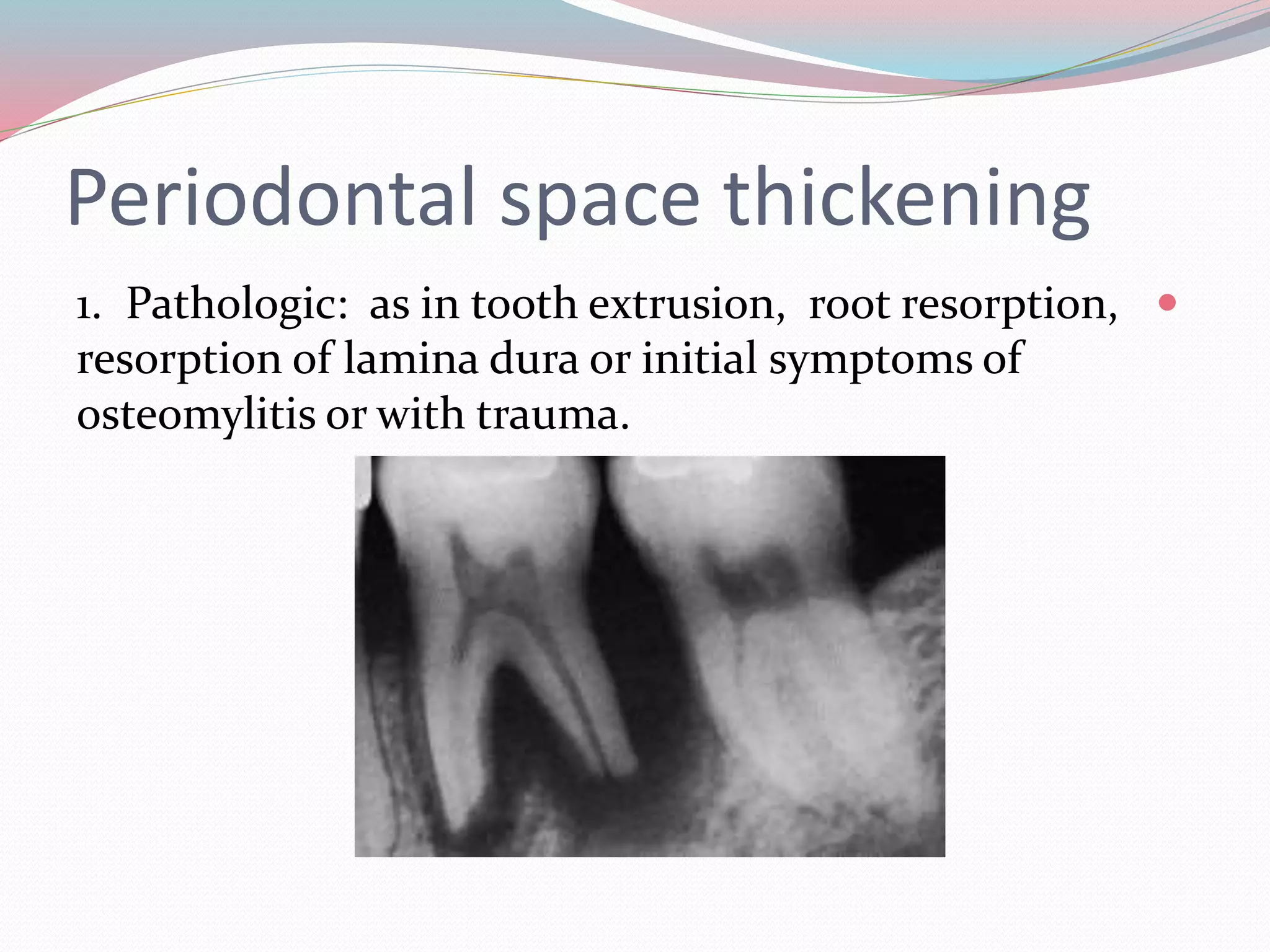Dental common disease on x-ray | by Dr.mohammad nameer | PPTX