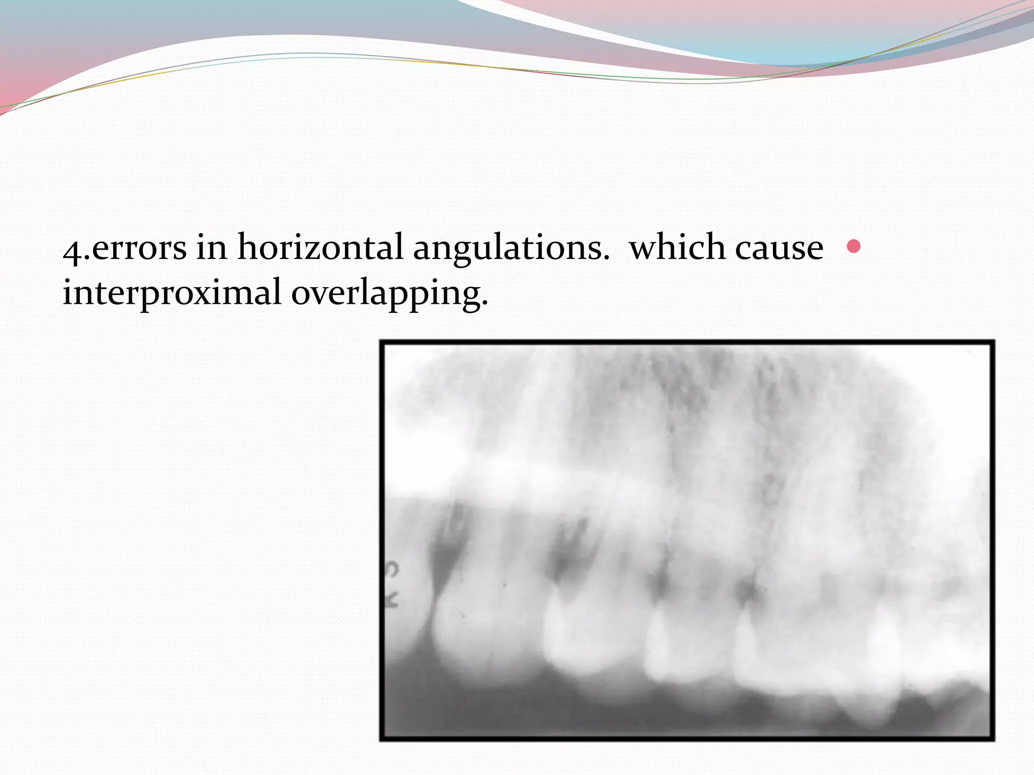 Dental common disease on x-ray | by Dr.mohammad nameer | PPTX