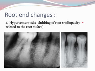 Dental common disease on x-ray | by Dr.mohammad nameer | PPTX