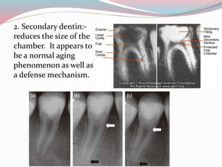 Dental common disease on x-ray | by Dr.mohammad nameer | PPTX