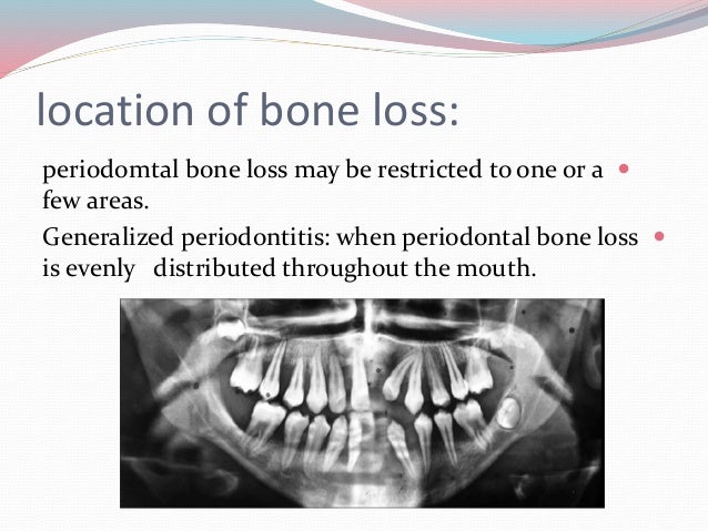 Dental common disease on x-ray | by Dr.mohammad nameer