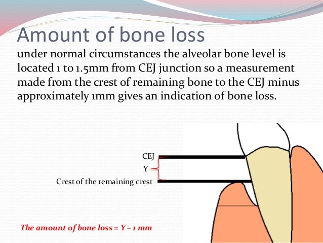 Dental common disease on x-ray | by Dr.mohammad nameer