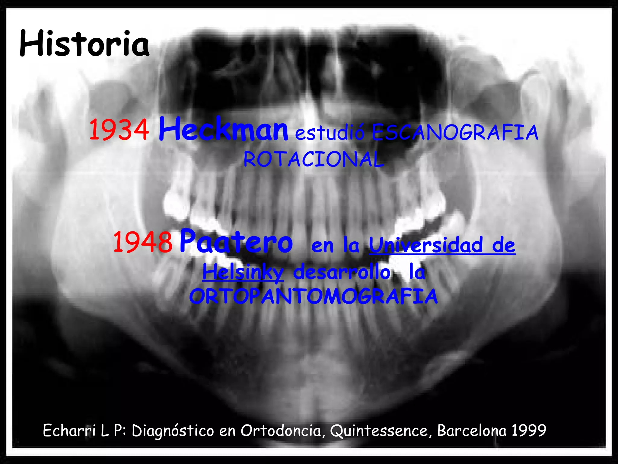 RadiografíA PanoráMica Blog | PPT