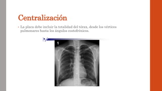 Radiografía de tórax | PPTX