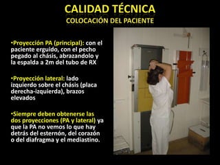 Radiografía de tórax | PPTX