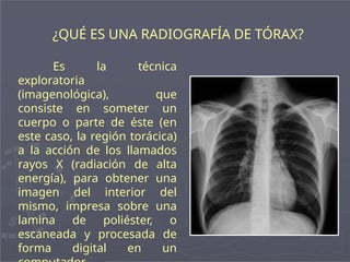 Radiografía de Tórax - Clínica I - Modificada.pptx