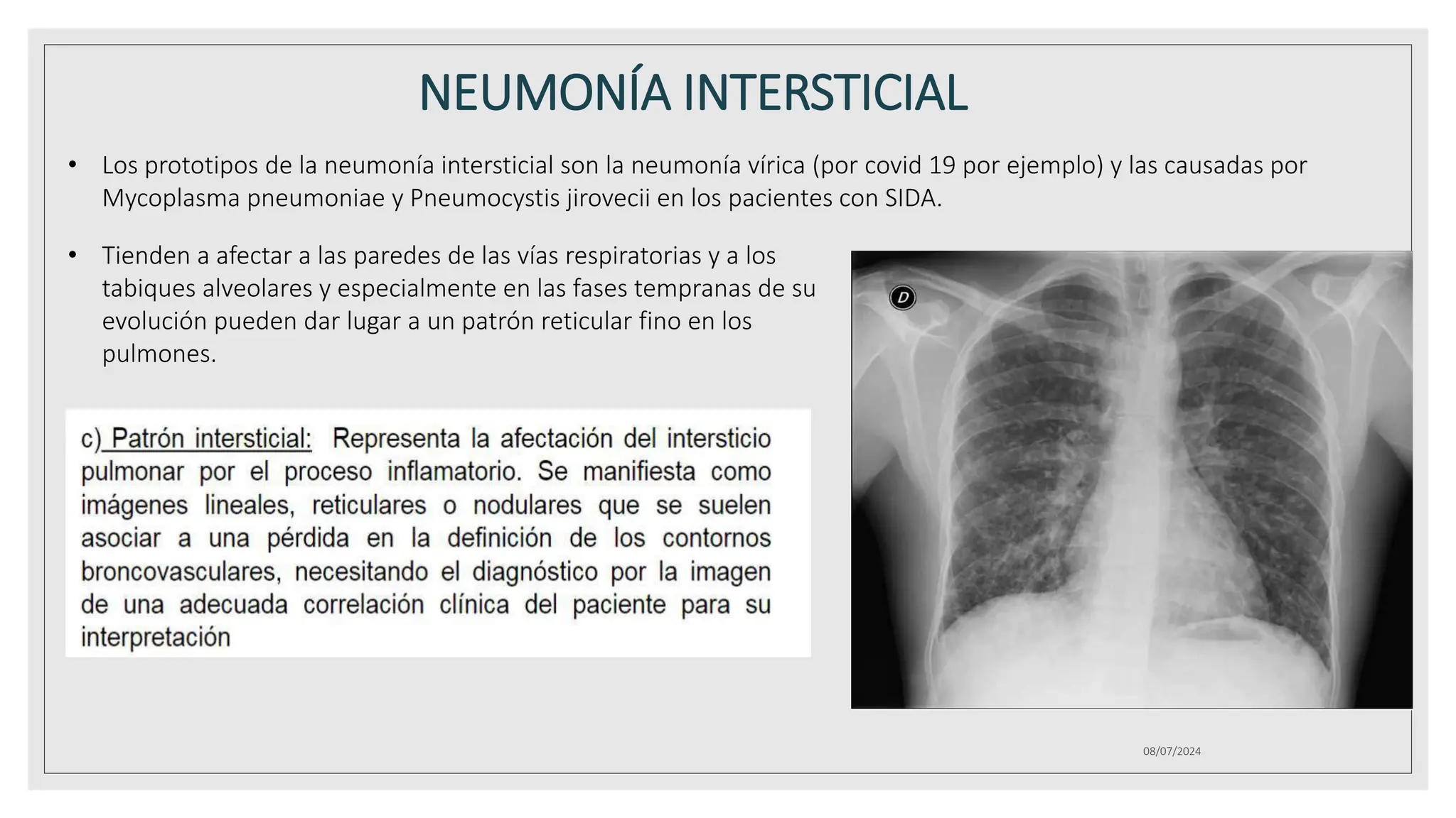 Radiografía de Tórax patológico y normal.pptx