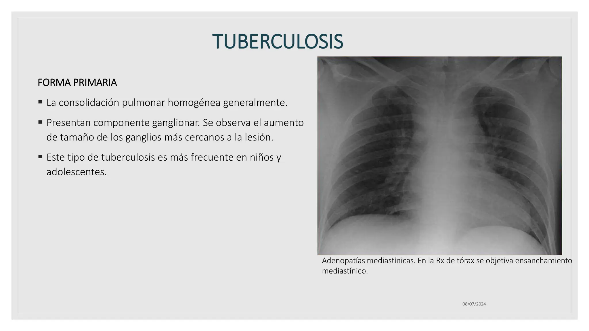 Radiografía de Tórax patológico y normal.pptx