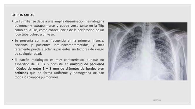 Radiografía de Tórax patológico y normal.pptx