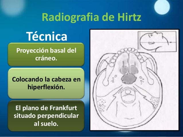 Radiografías en Cirugía Maxilofacial
