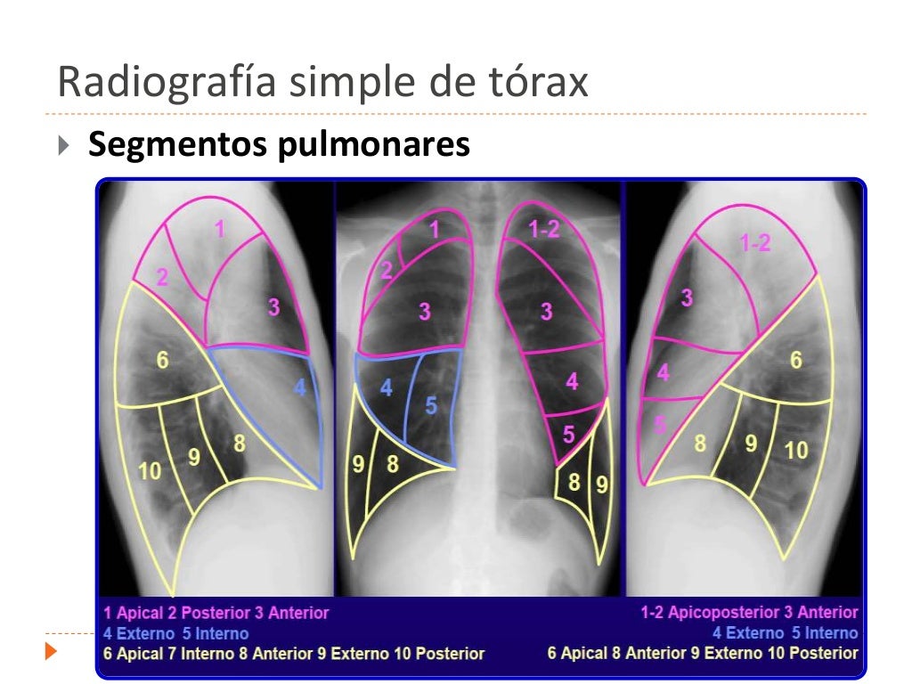 Radiografía simple y tomografía de tórax