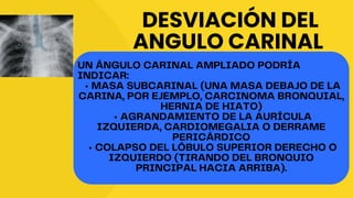 Radiografía y Tomografía de tórax, pulmón y pleura | PDF