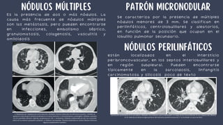 Radiografía y Tomografía de tórax, pulmón y pleura | PDF