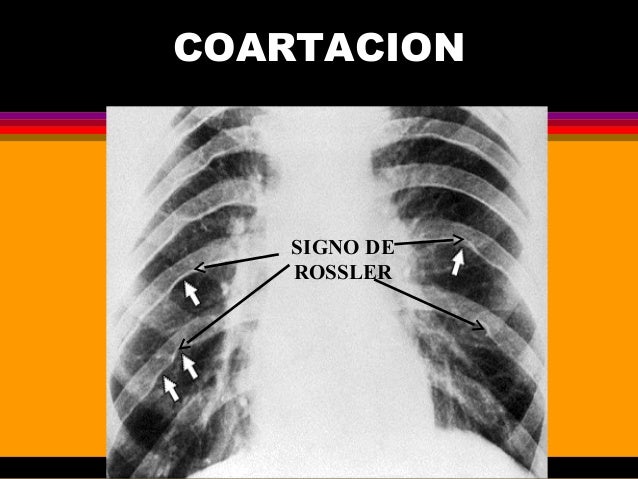 Radiografia