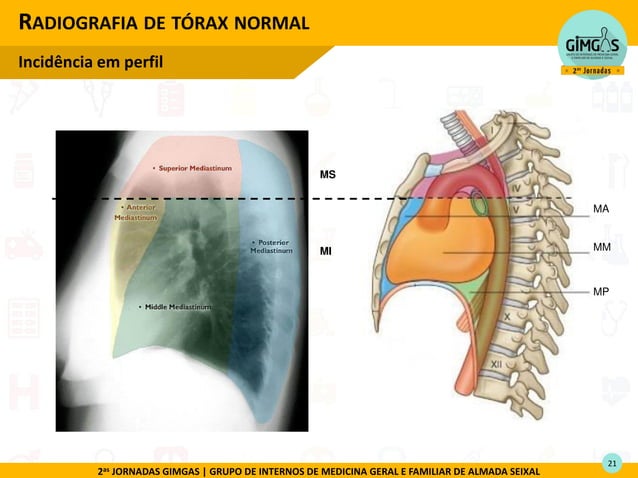 Radiografia-de-Tórax-em-Síntese-AS.pdf
