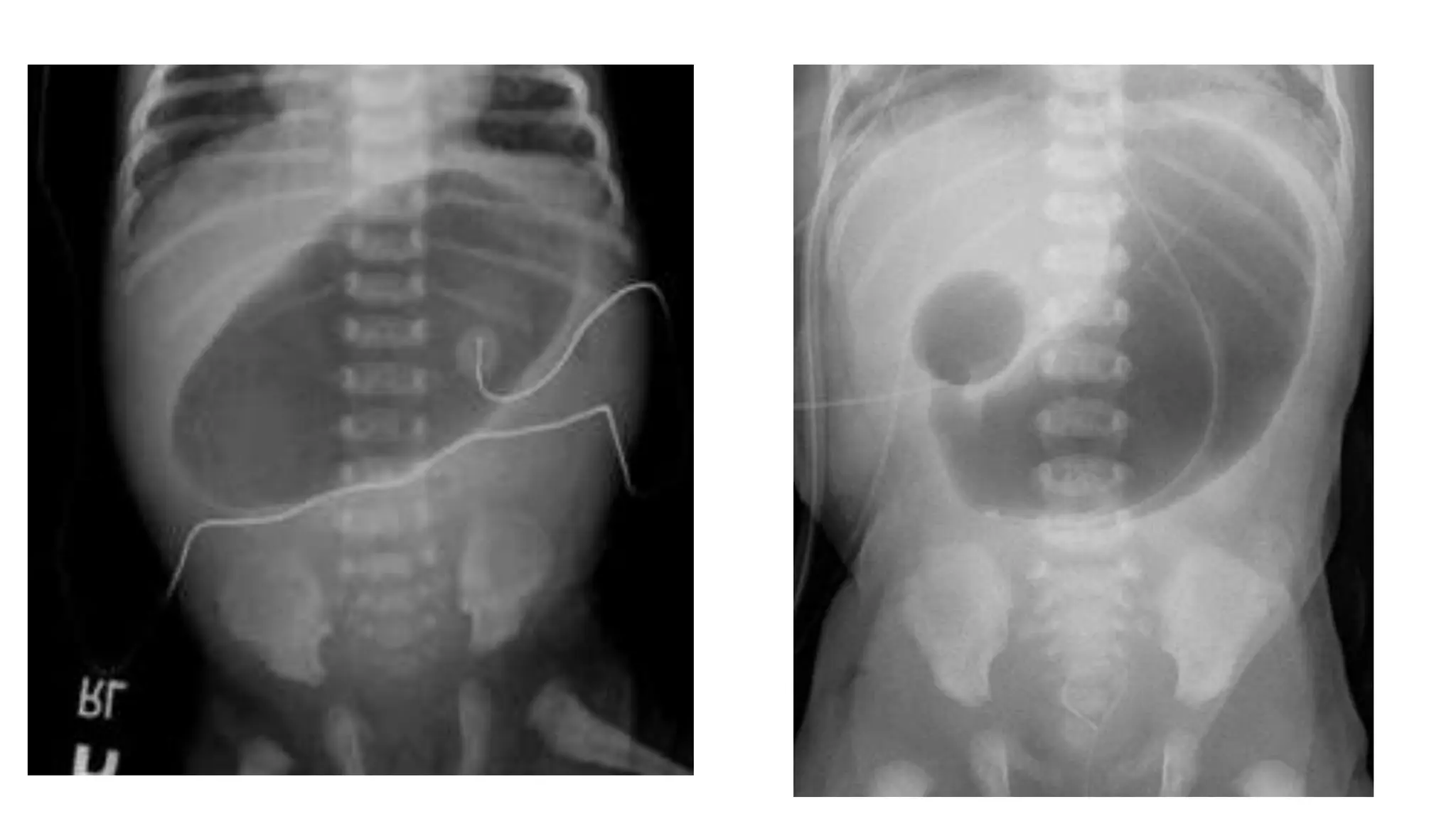 RADIOGRAFI_ABDOMEN_radiologi_abdomen_.pptx