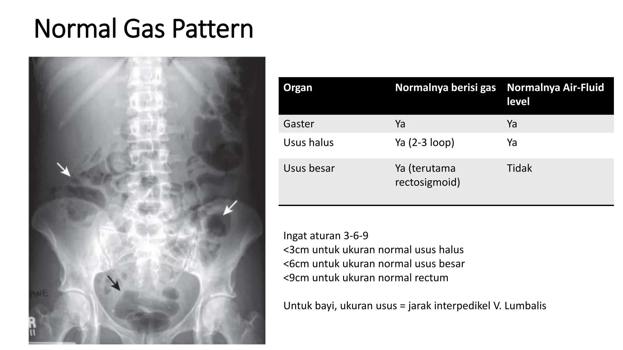 RADIOGRAFI_ABDOMEN_radiologi_abdomen_.pptx