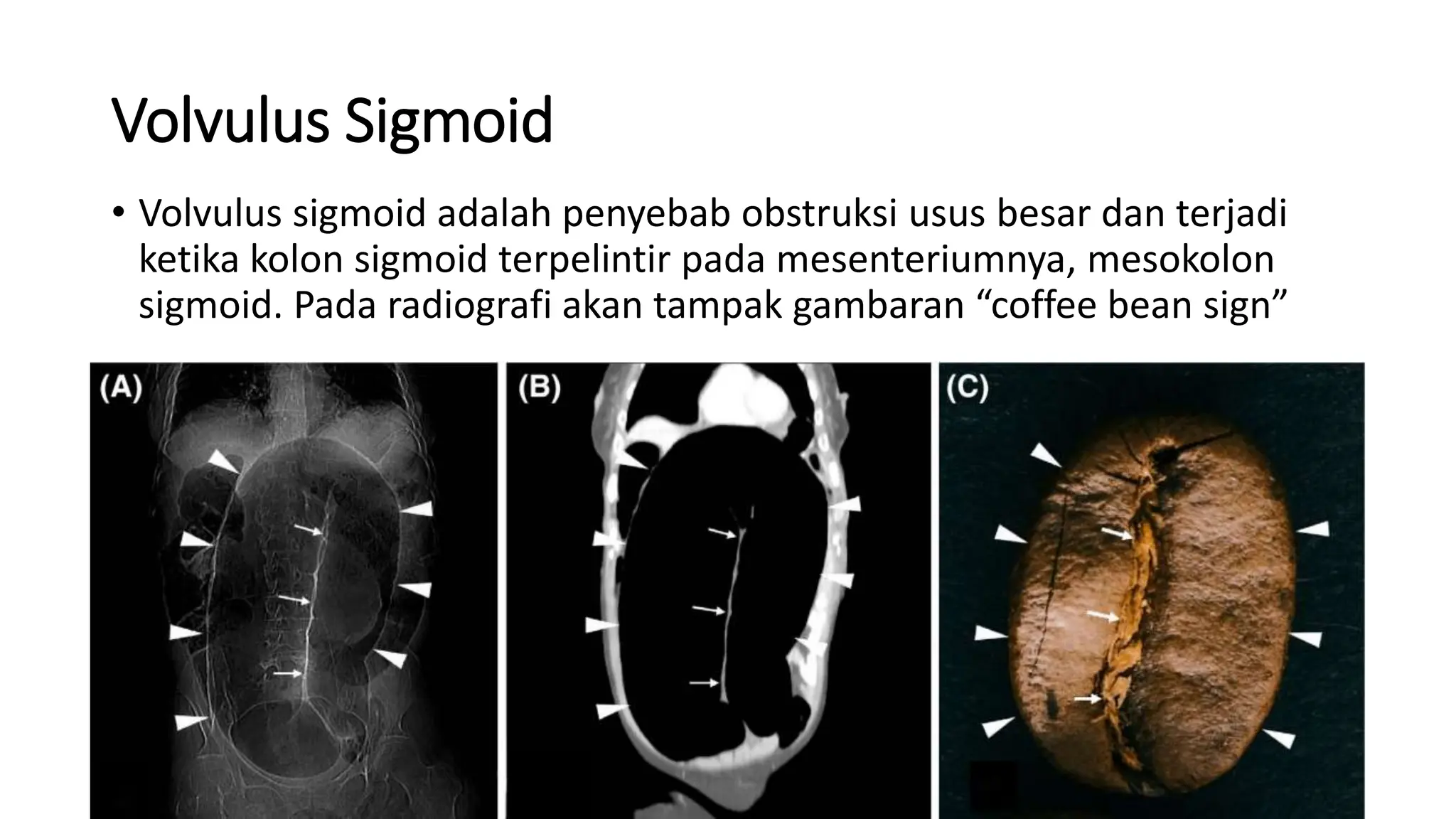 RADIOGRAFI_ABDOMEN_radiologi_abdomen_.pptx