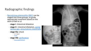 RADIOGRAFI_ABDOMEN_radiologi_abdomen_.pptx