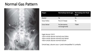 RADIOGRAFI_ABDOMEN_radiologi_abdomen_.pptx