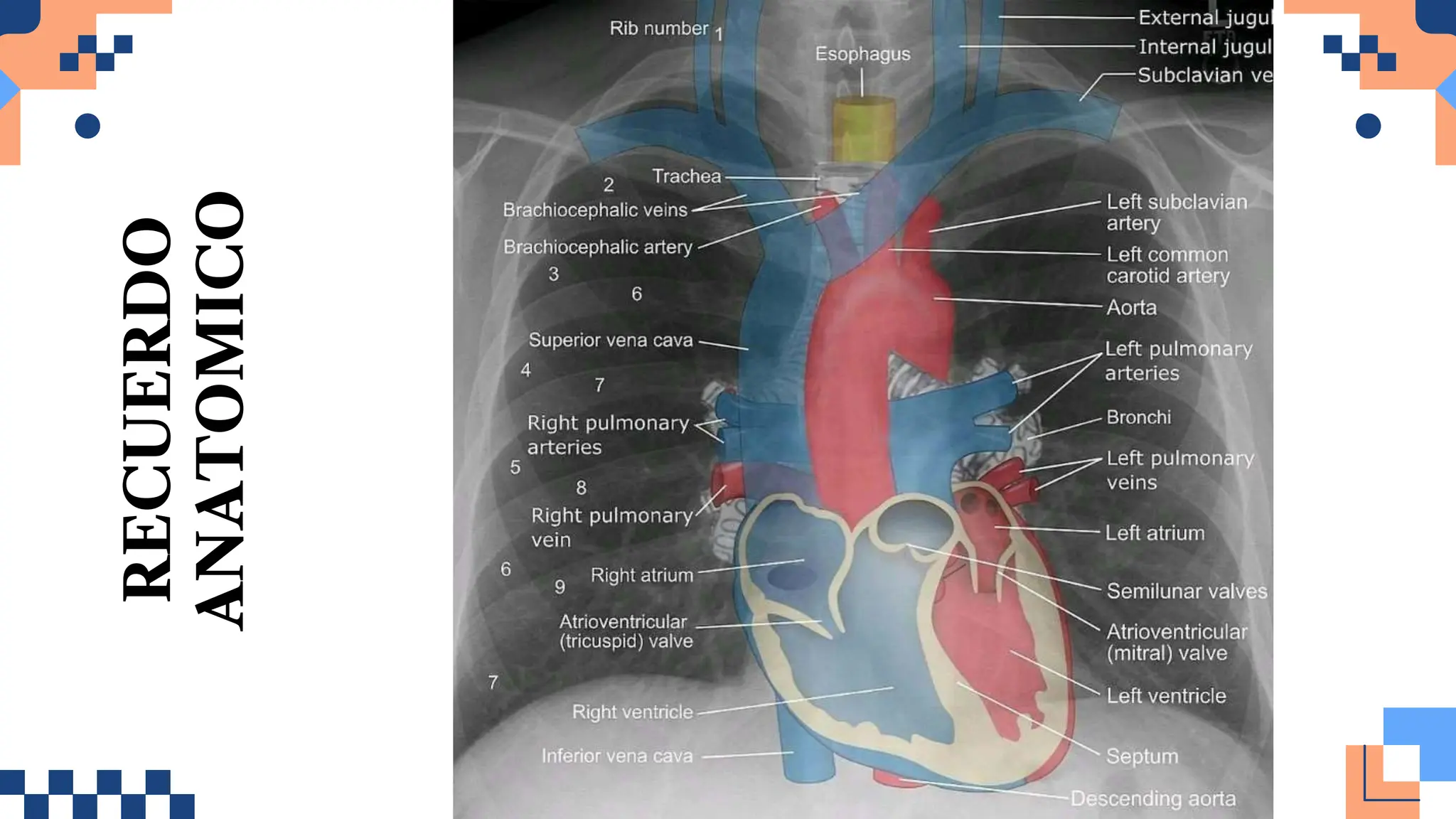 Radiografia básica para interpretar el Corazon | PPTX | Lung and ...