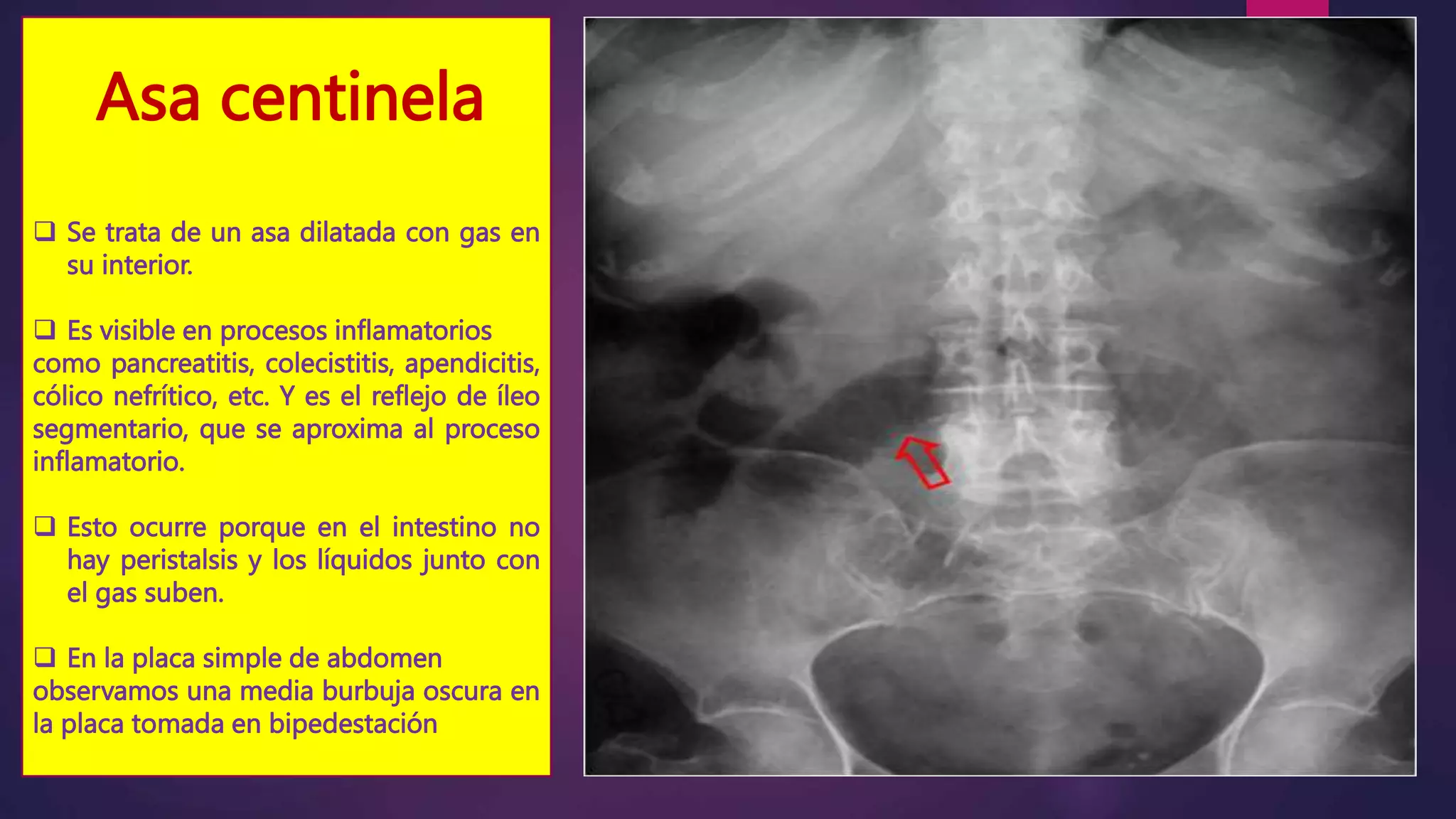 Radiografia de abdomen.pptx