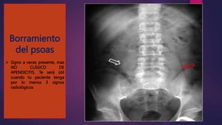 Radiografia de abdomen.pptx