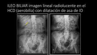 Radiografia de abdomen patologia | PPTX