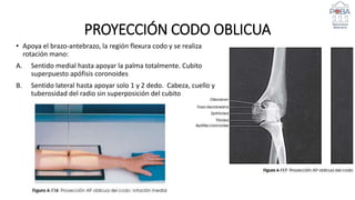 Presentación de Radiografia de Hombro y Codo.pptx