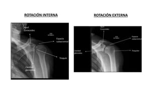 Presentación de Radiografia de Hombro y Codo.pptx