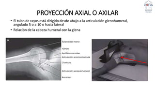 Presentación de Radiografia de Hombro y Codo.pptx