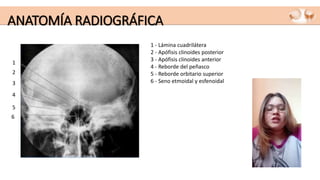 radiografia de Silla Turca posicionamiento estudiantes | PPTX