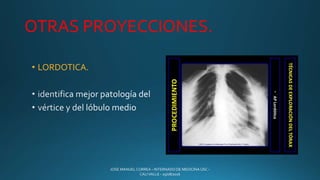 Radiografia de torax | PDF