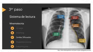 Radiografia de torax interpretacion.pptx