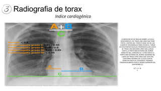 RADIOGRAFIA DE TORAX y sus generalidades.pdf
