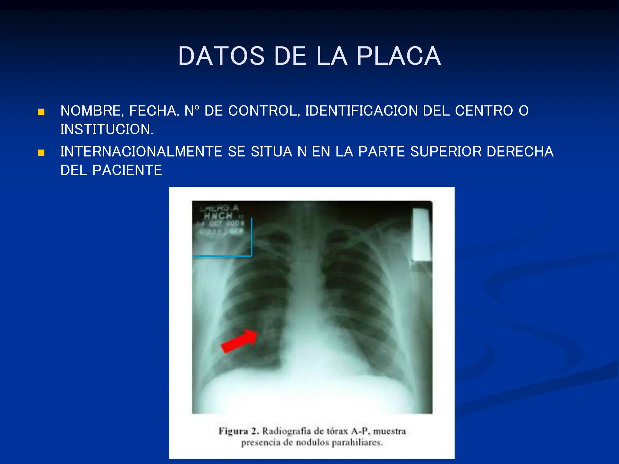 Introduccion Radiografia De Toraxclase 4ppt