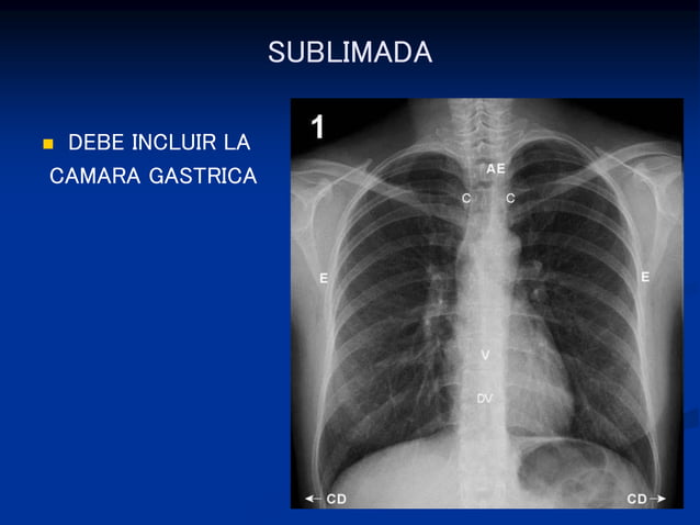 introduccion RADIOGRAFIA DE TORAX(CLASE) (4).ppt