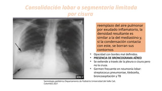Radiografia De Torax Radiografia De Tora Pptx