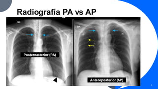 Radiografia de torax normal .pptx